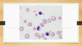 NRBC - Nucleated Red Blood Cells | PPTX
