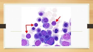 NRBC - Nucleated Red Blood Cells | PPTX