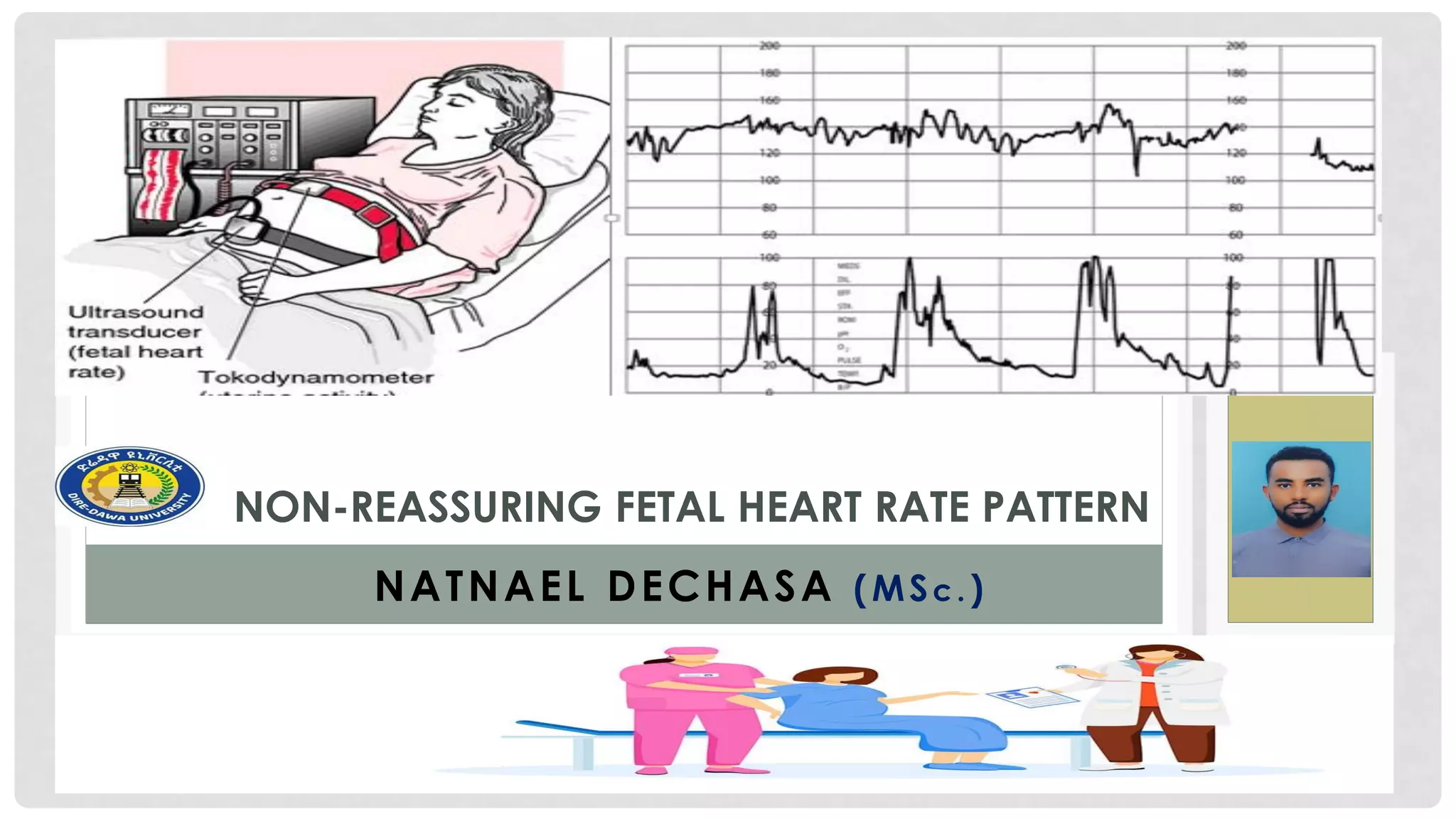 NRFHRP [ Natnael Dechasa ] PPT.pdf