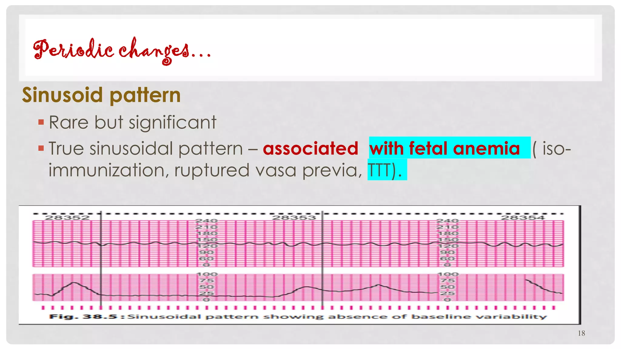 NRFHRP [ Natnael Dechasa ] PPT.pdf
