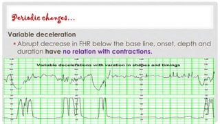 NRFHRP [ Natnael Dechasa ] PPT.pdf
