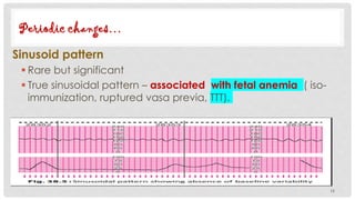 NRFHRP [ Natnael Dechasa ] PPT.pdf