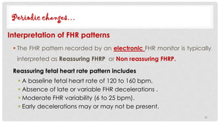 NRFHRP [ Natnael Dechasa ] PPT.pdf