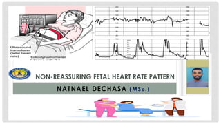 Non Reassuring Fetal Heart Rate