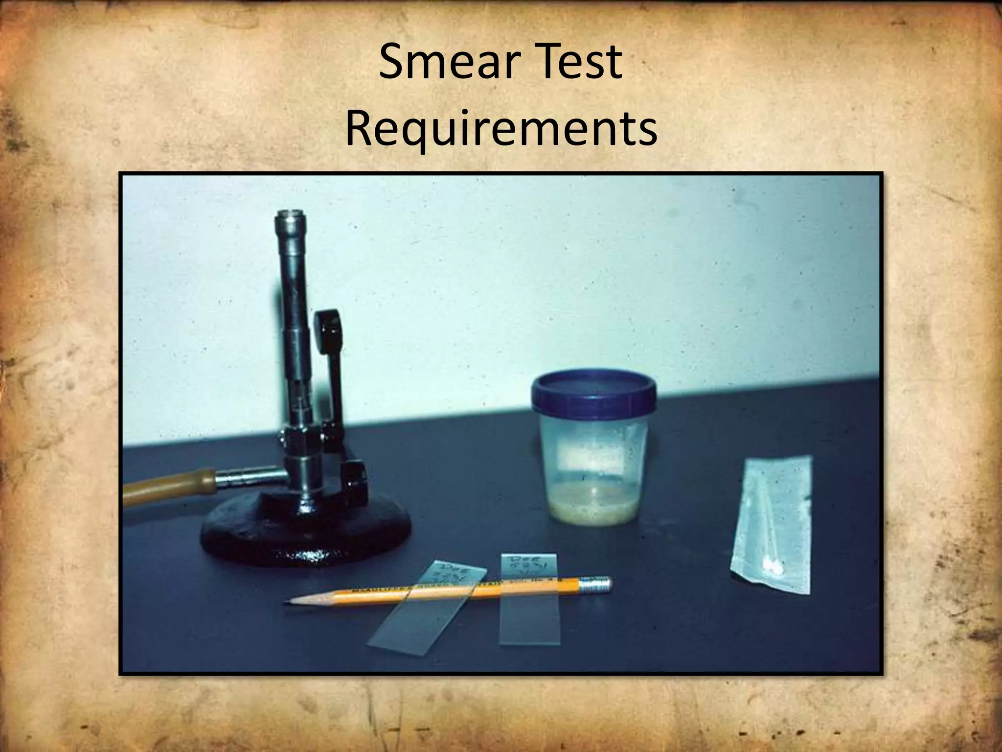 Use of Sputum sample for diagnosis of disease, interpretation ...