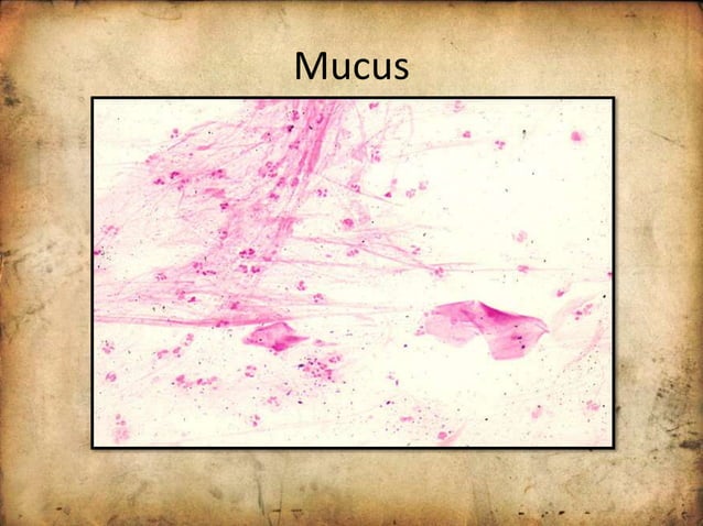 Use of Sputum sample for diagnosis of disease, interpretation ...