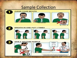 Sputum Sample Collection