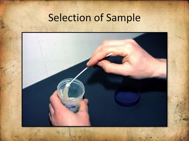 Use of Sputum sample for diagnosis of disease, interpretation ...