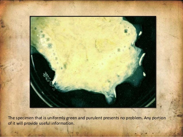 Use of Sputum sample for diagnosis of disease, interpretation, treatm…