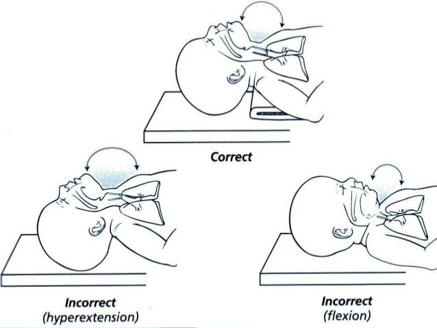 Neonatal Resuscitation Program