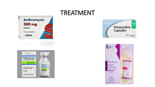 Non Resolving Pneumonia | PPTX