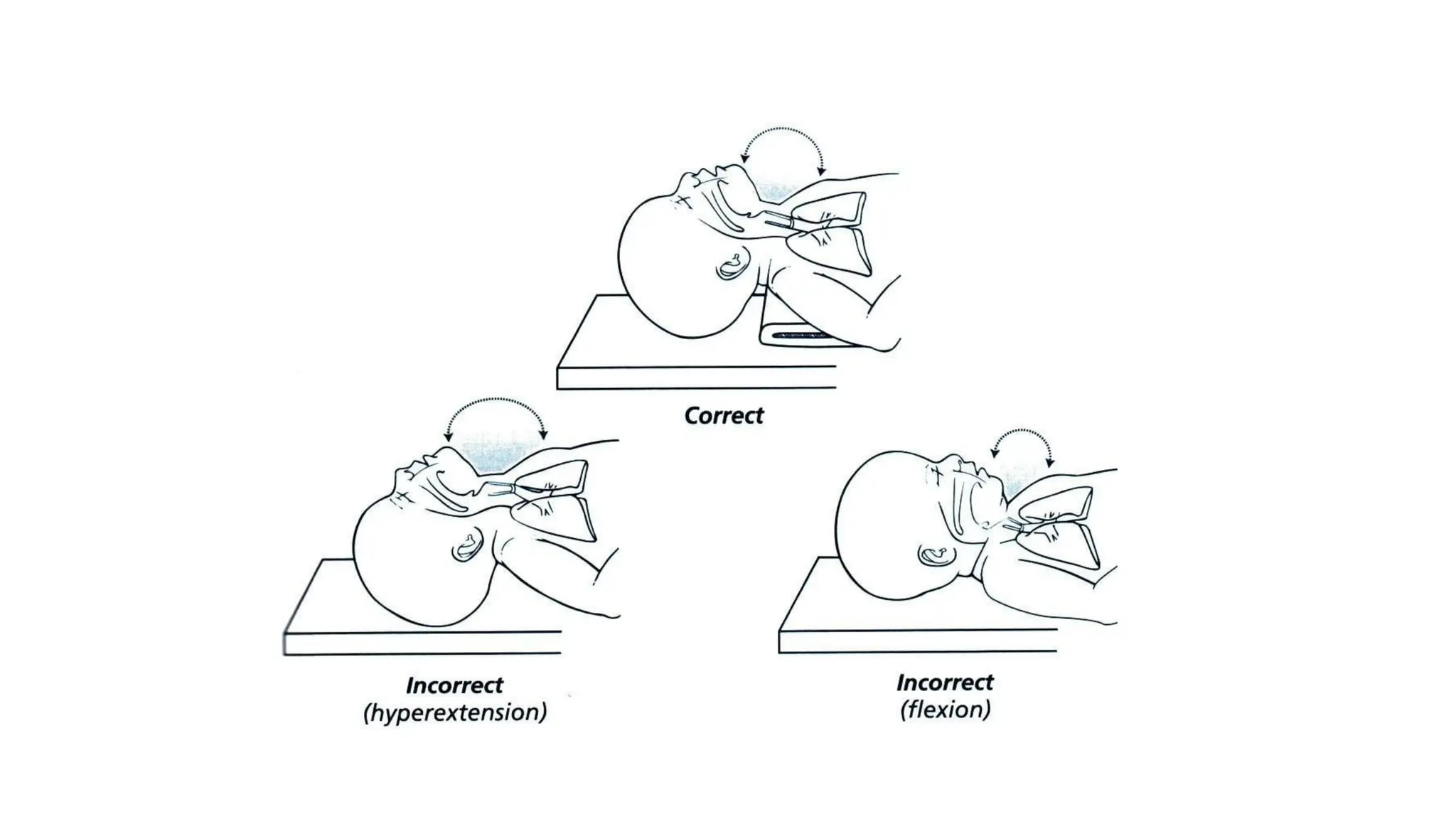 Neonatal resuscitation protocol of pediatric.pptx