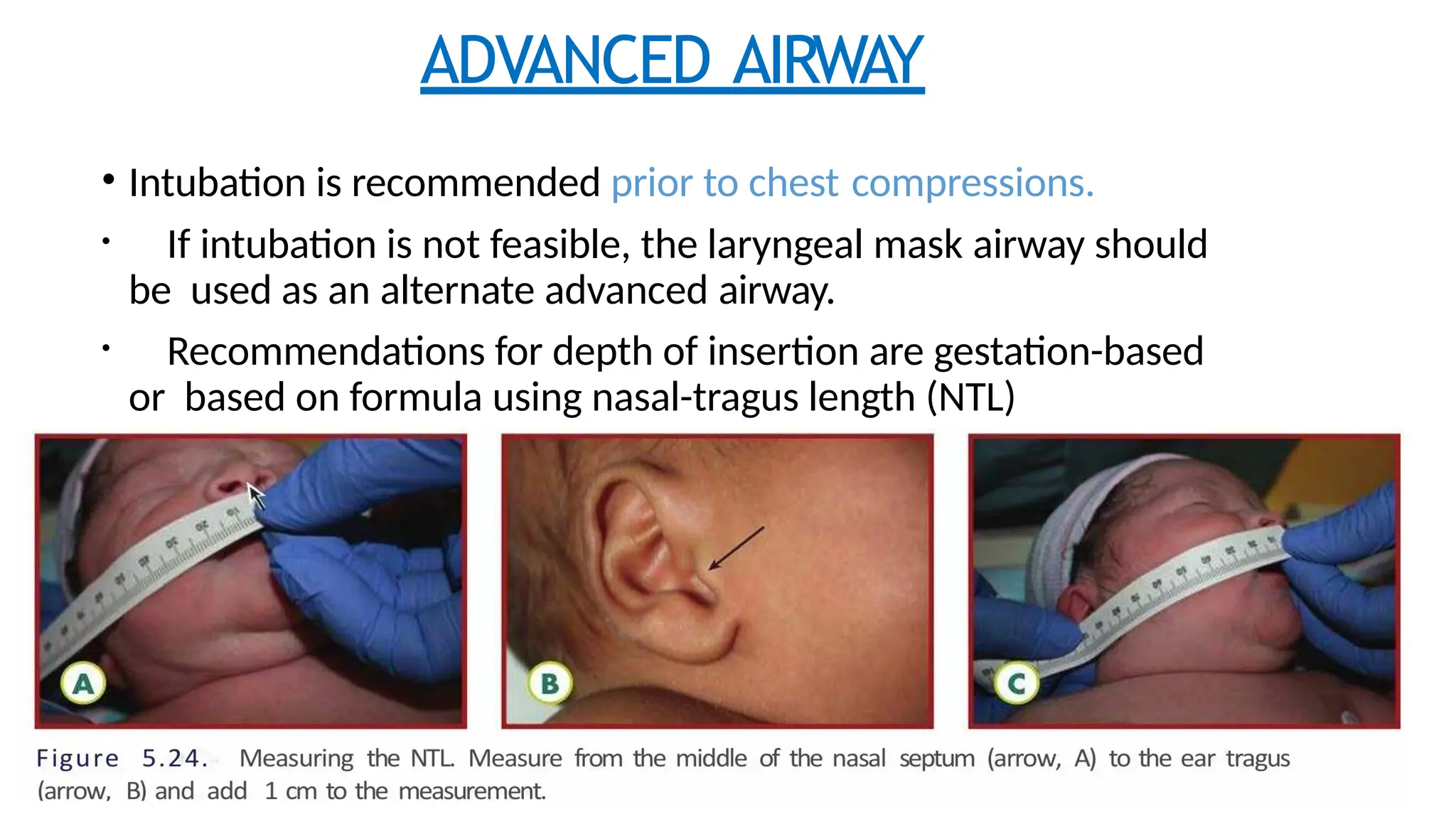 Neonatal resuscitation protocol of pediatric.pptx