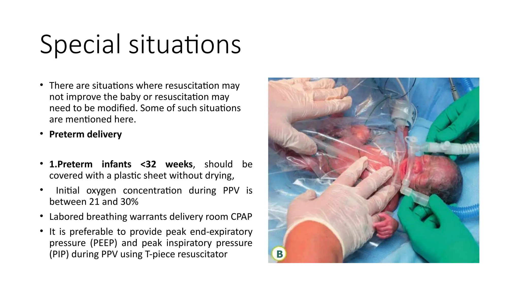 Neonatal resuscitation protocol of pediatric.pptx
