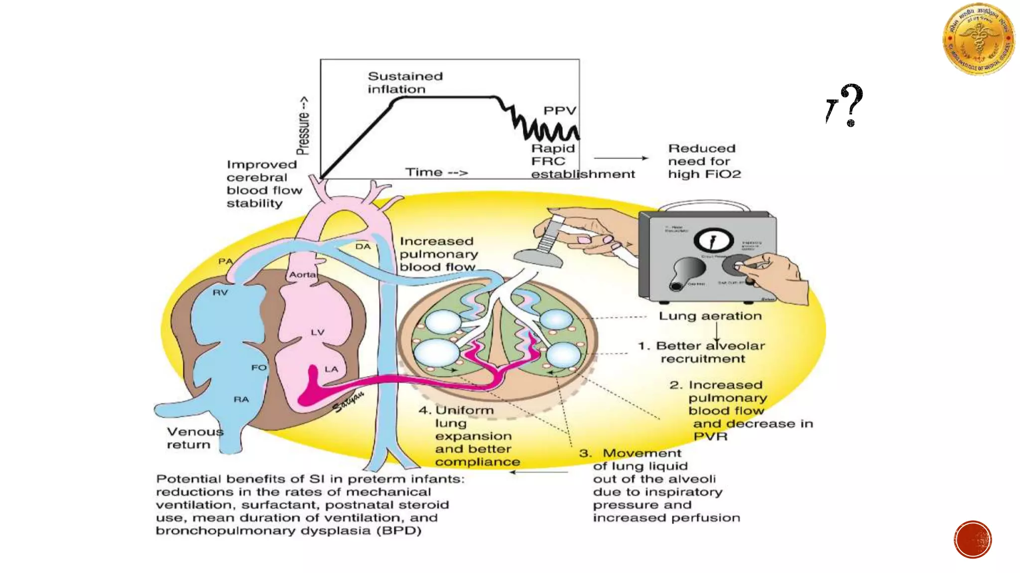 NRP neonatal resuscitation protocol recommendations 2020 | PPTX | First ...
