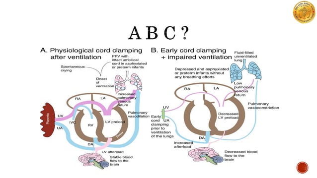 NRP neonatal resuscitation protocol recommendations 2020