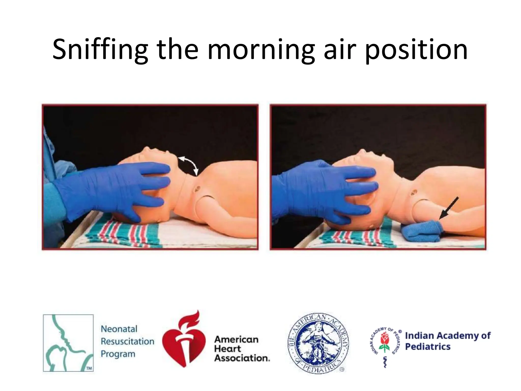 Neonatal Resuscitation Program eighth edition.pptx