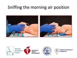 Neonatal Resuscitation Program eighth edition.pptx