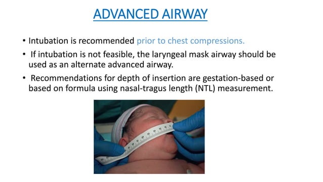 NEONATAL RESUSCITATION PROGRAM/NALS - LATEST GUIDELINES 7TH EDITION ...