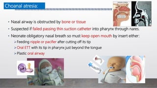 special consideration in NRP | PPTX