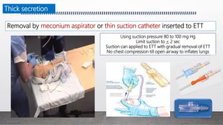 special consideration in NRP | PPTX