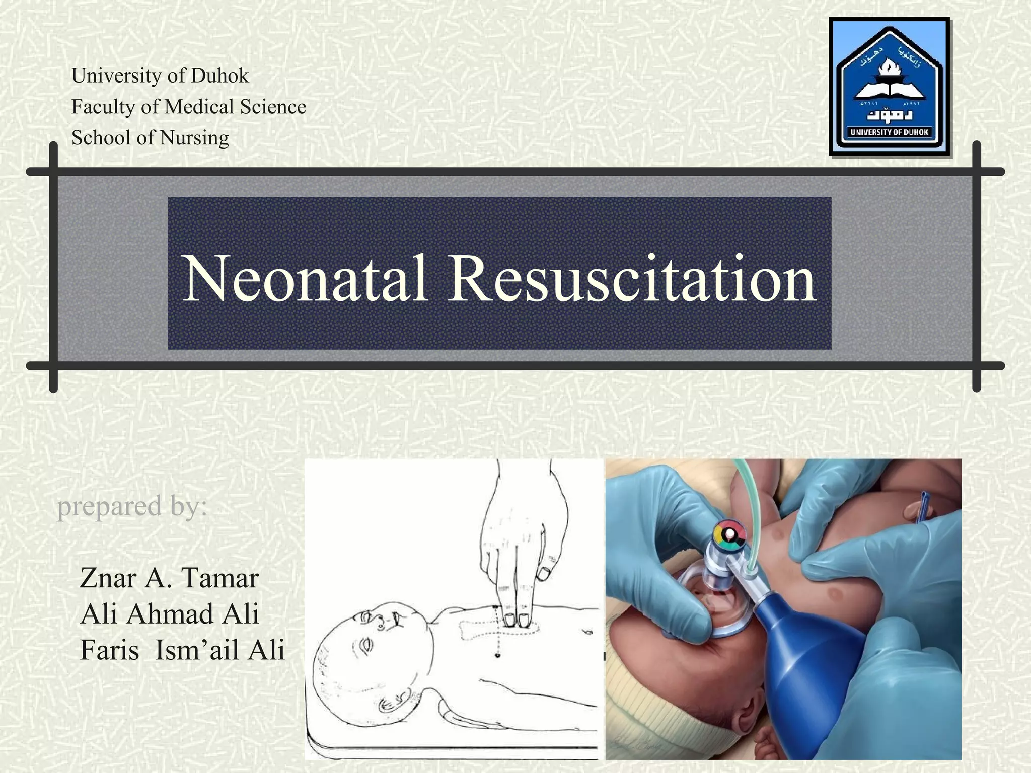 Neonatal Resuscitation (NR),(Kurdistan) | PPT