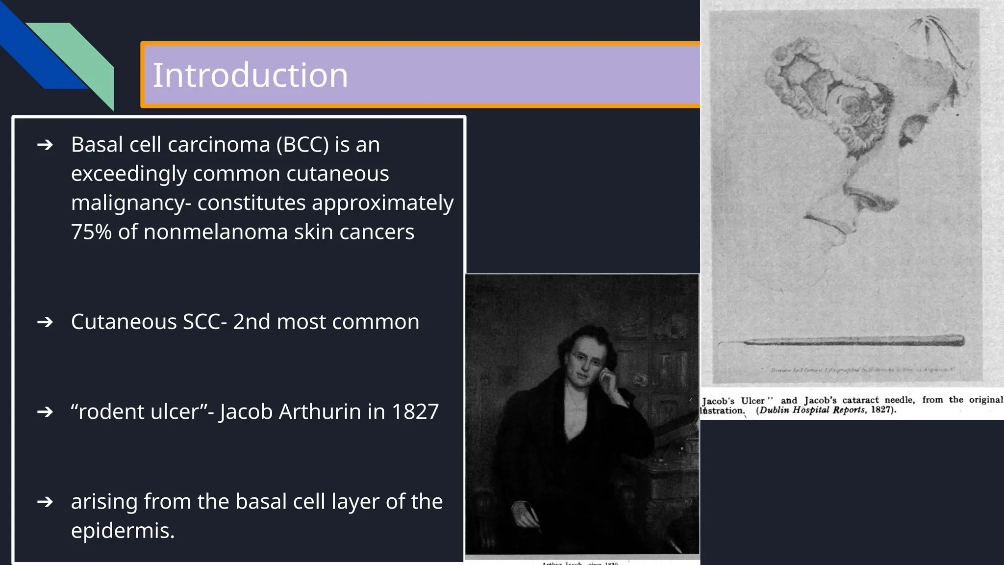 Management of Basal_cell_carcinoma of Head and neck.pptx
