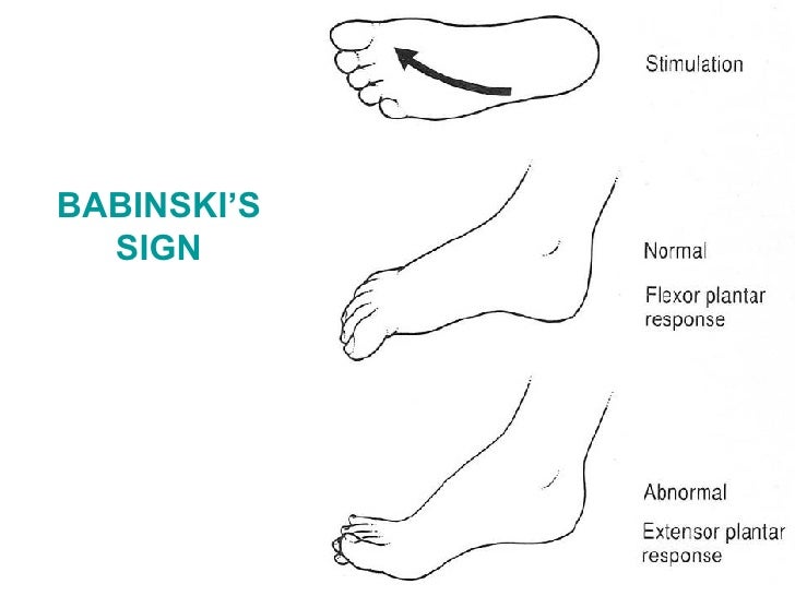 Ns9. Motor Pathways. Compressed File