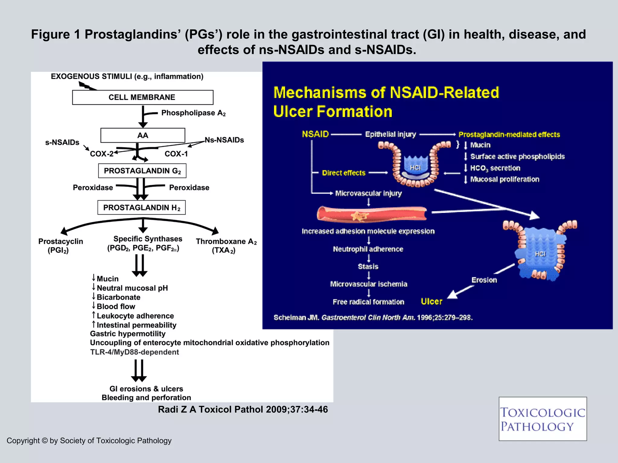 The organs damages as side effects of NSAIDs | PPT
