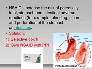 non-steroidal anti-inflammatory drugs (NSAIDs) | PPT