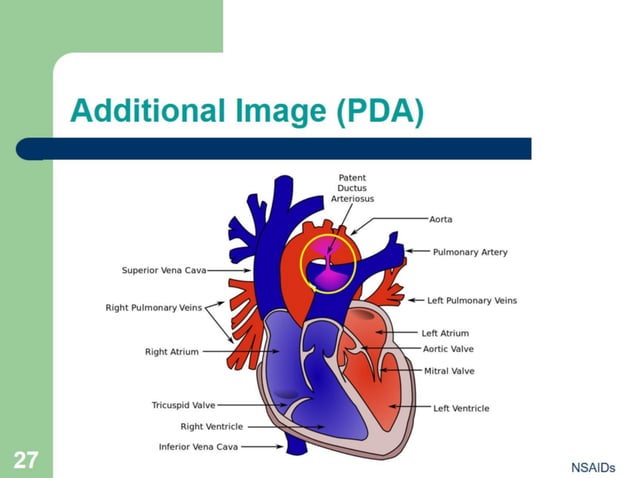 NSAIDs {Anti- Pyretic, Anti-inflammatory, and Analgesic} Pharmacology | PPT
