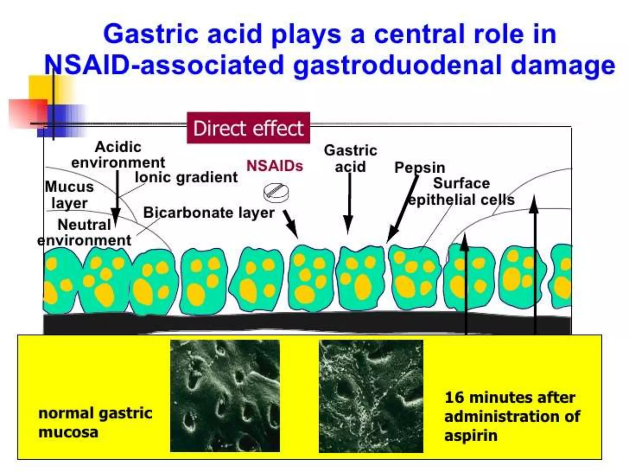 NSAIDs and ICON-G | PPT