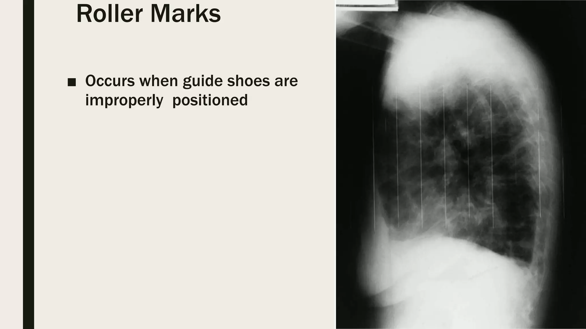 Radiographic screen film artifacts | PPTX