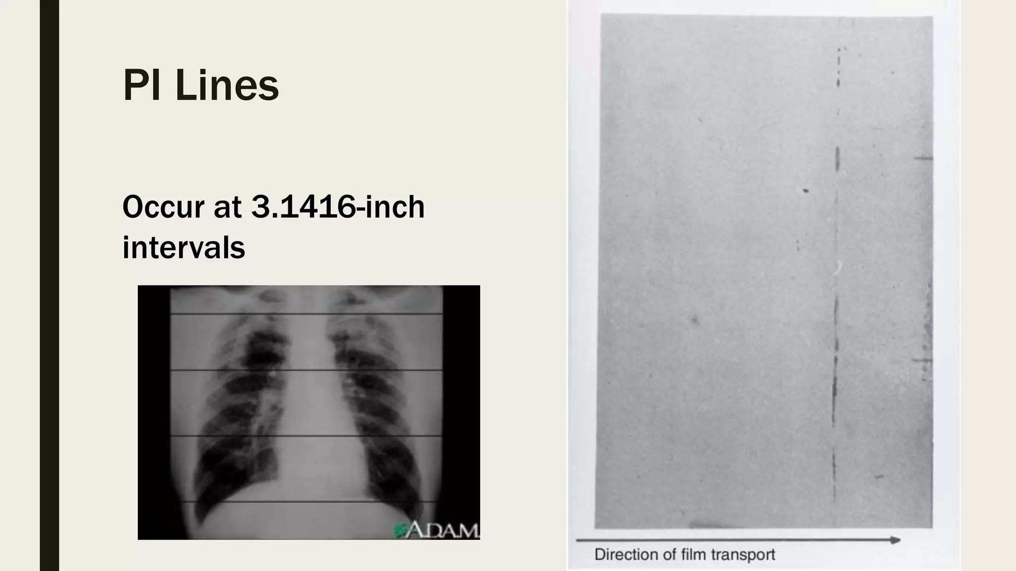 Radiographic screen film artifacts | PPTX