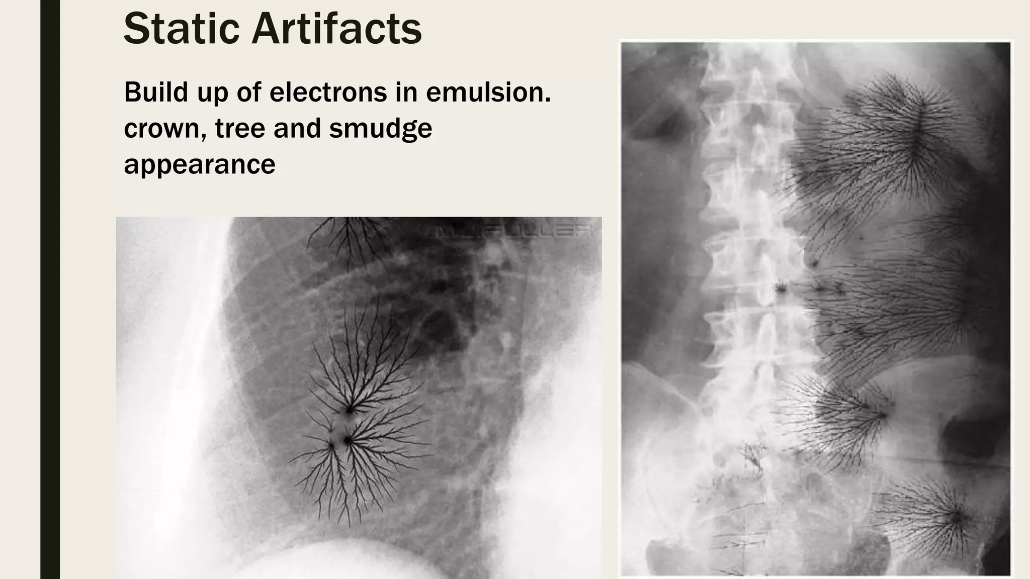 Radiographic screen film artifacts | PPTX