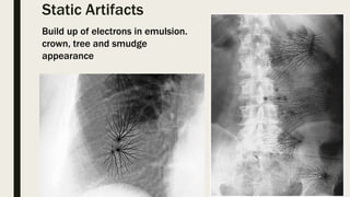 Radiographic screen film artifacts | PPTX