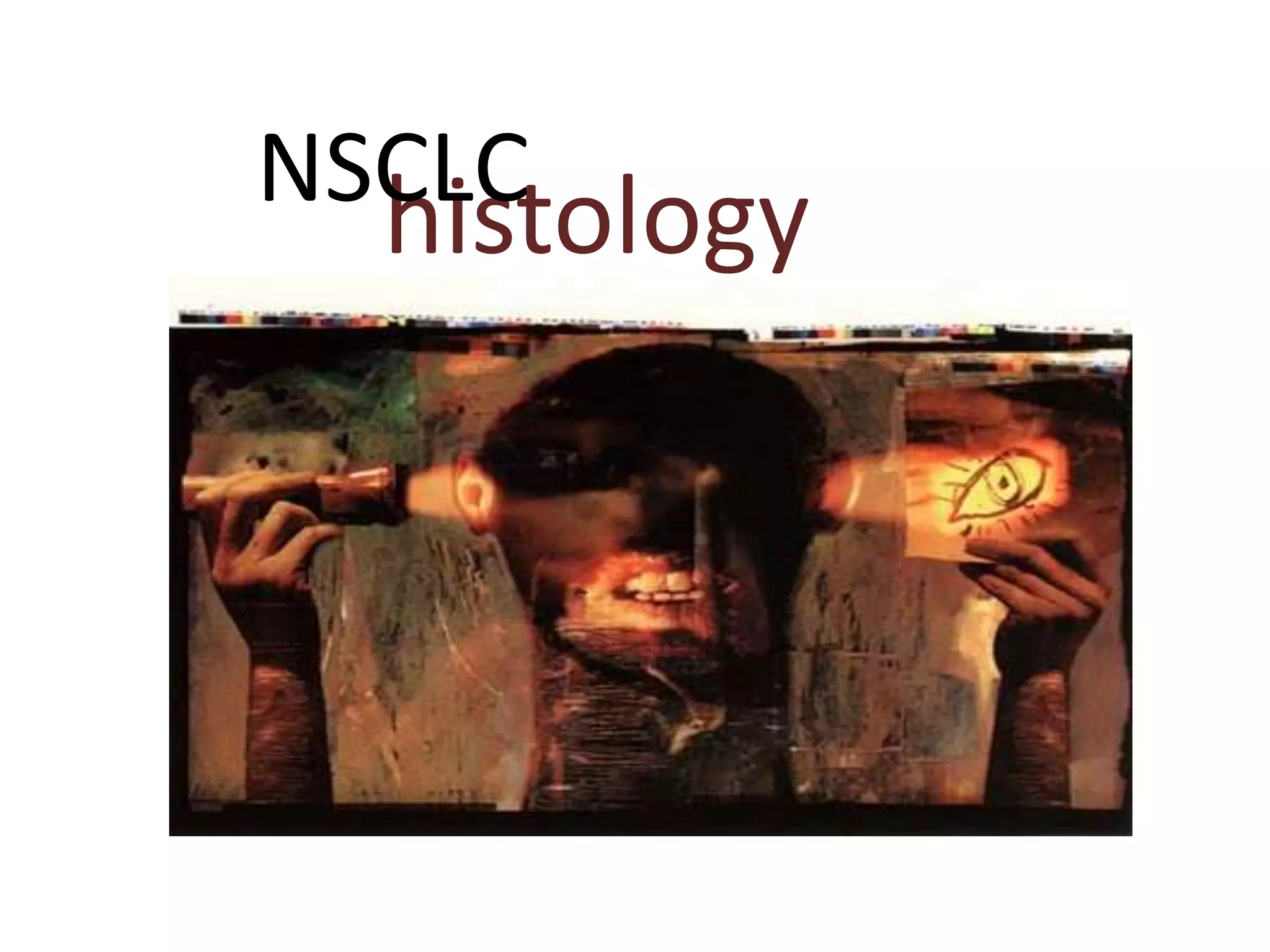 NSCLC management basics | PPTX