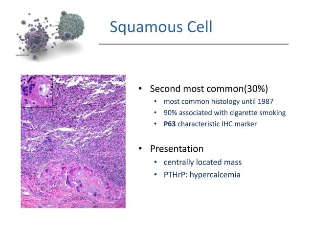 NSCLC management basics | PPTX