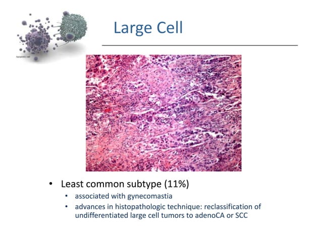 NSCLC management basics | PPTX