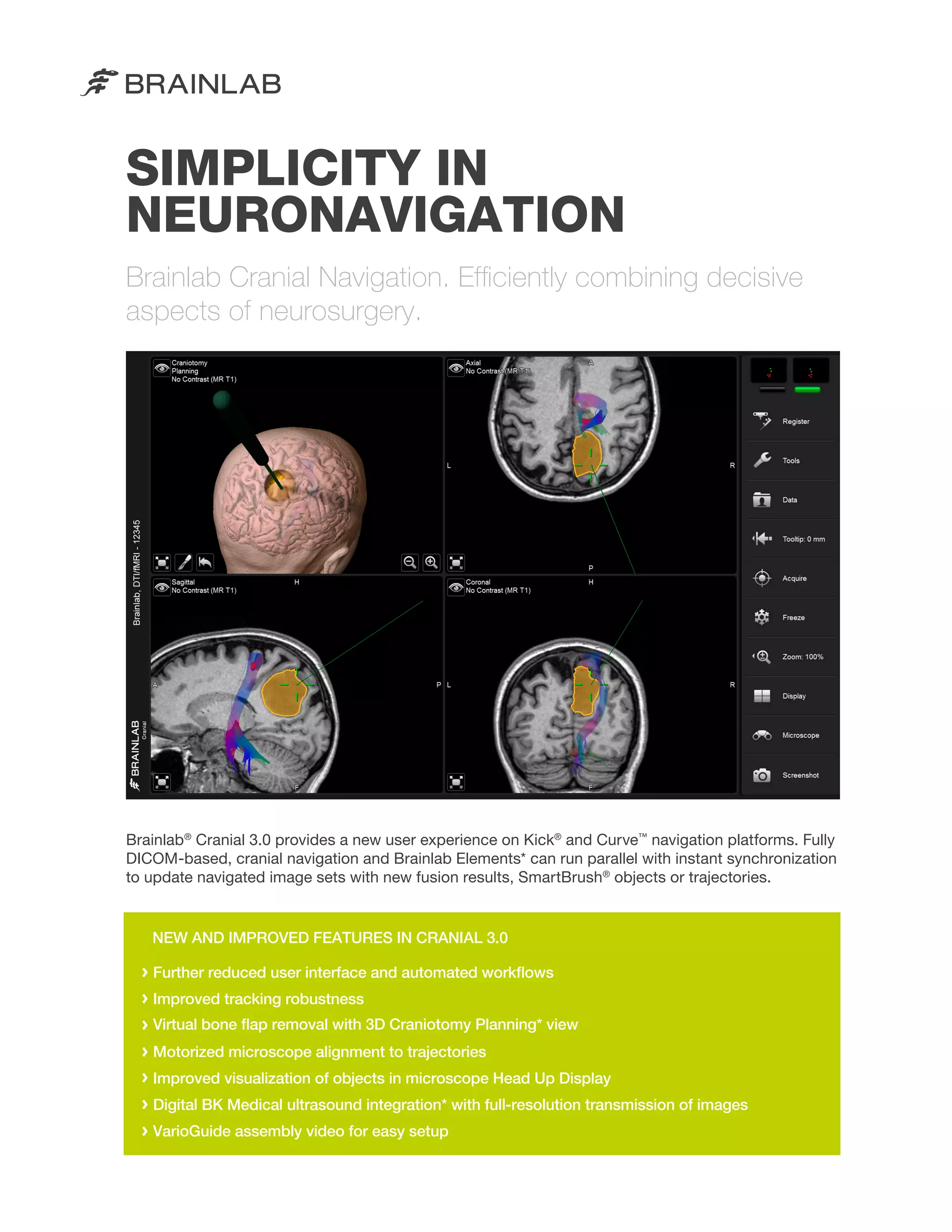 Simplicity in Neuronavigation | PDF
