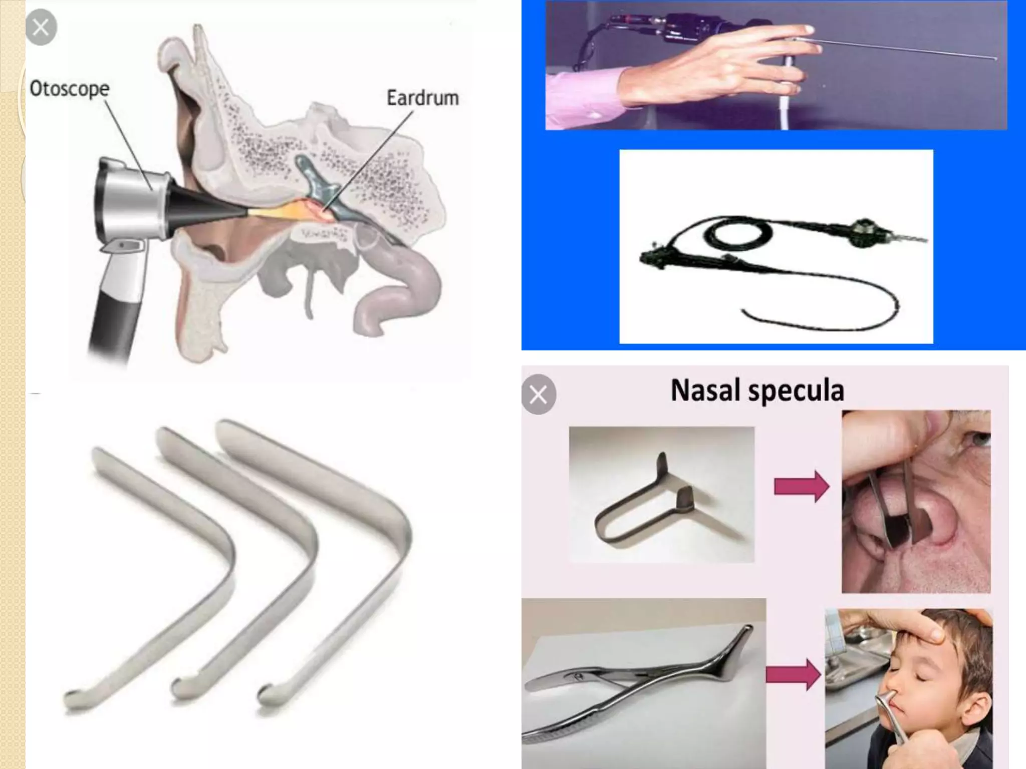 Nursing Assessment of ENT cases | PPTX