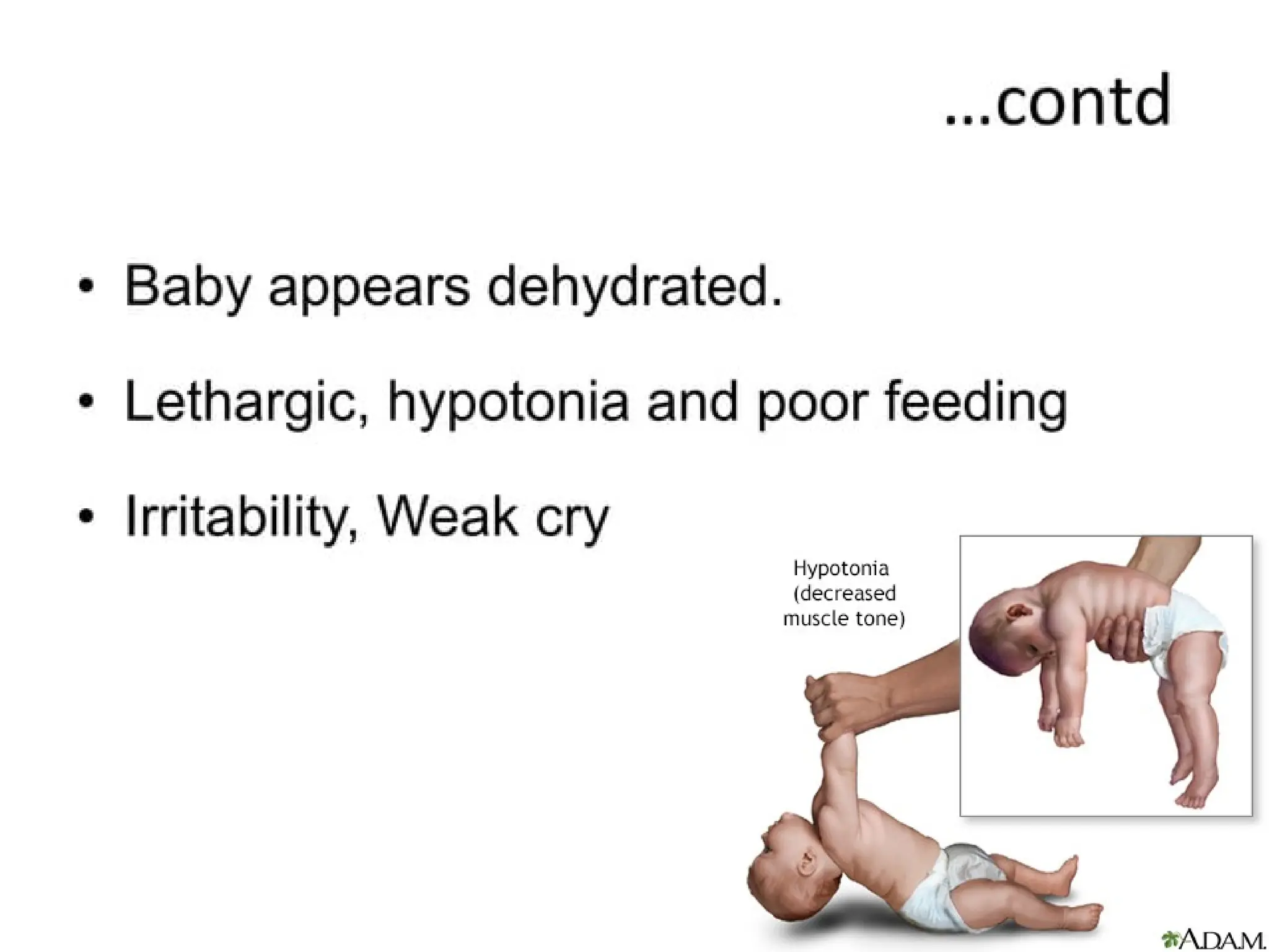 nursing management of neonatal hyperthermia .pptx
