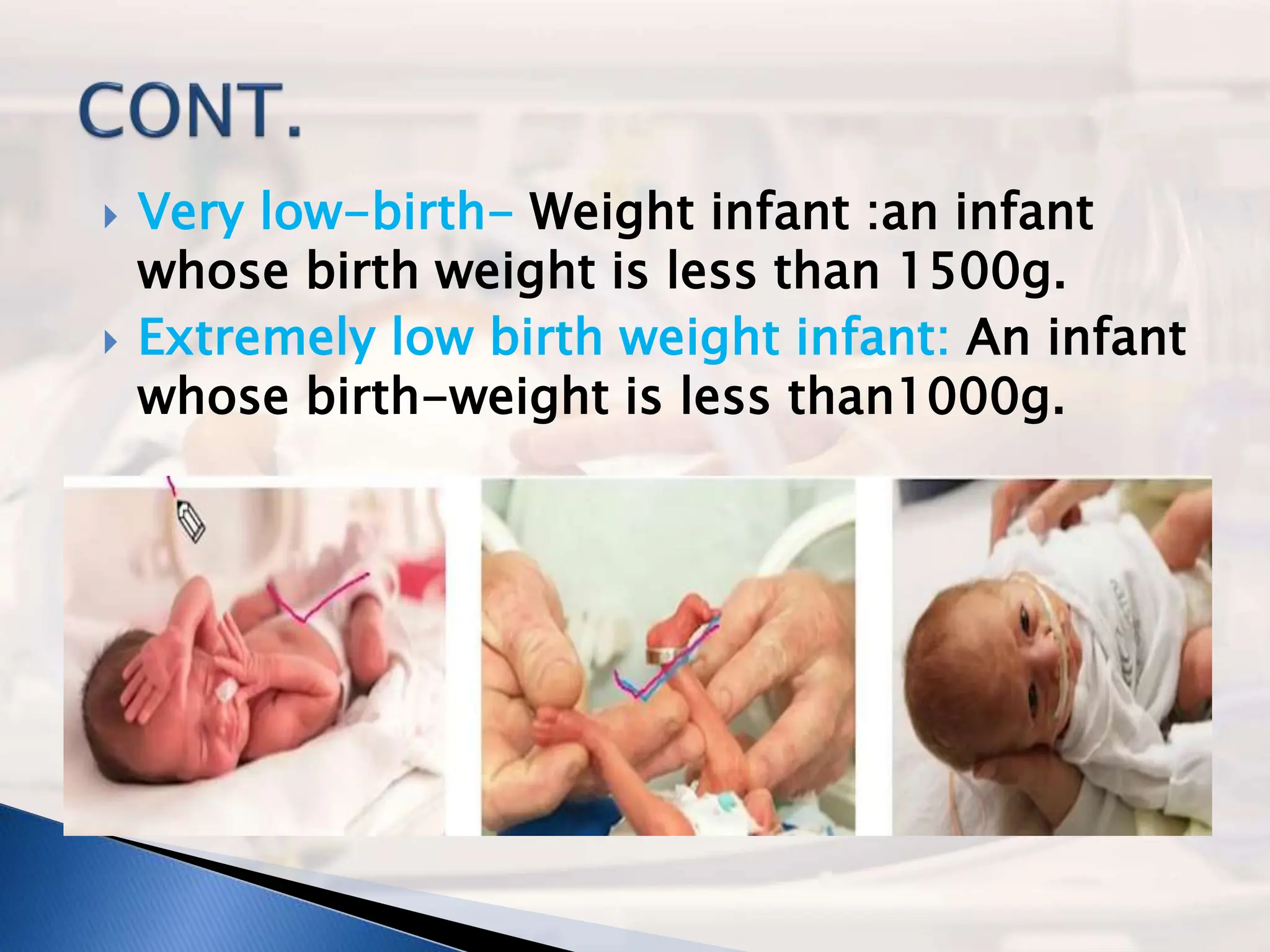 nursing management of low birth weight babies | PPTX