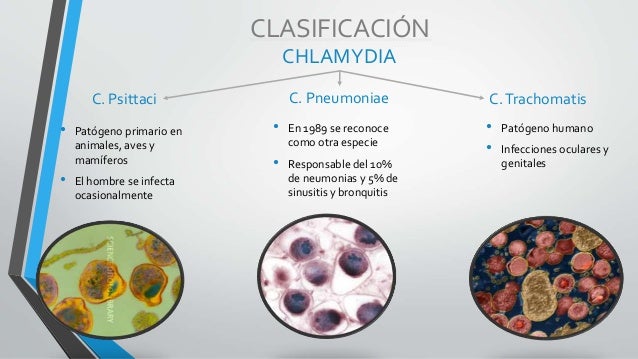 Chlamydia