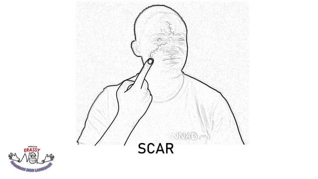 NSL Medical Part 1 (Namibian Sign Language) | PDF