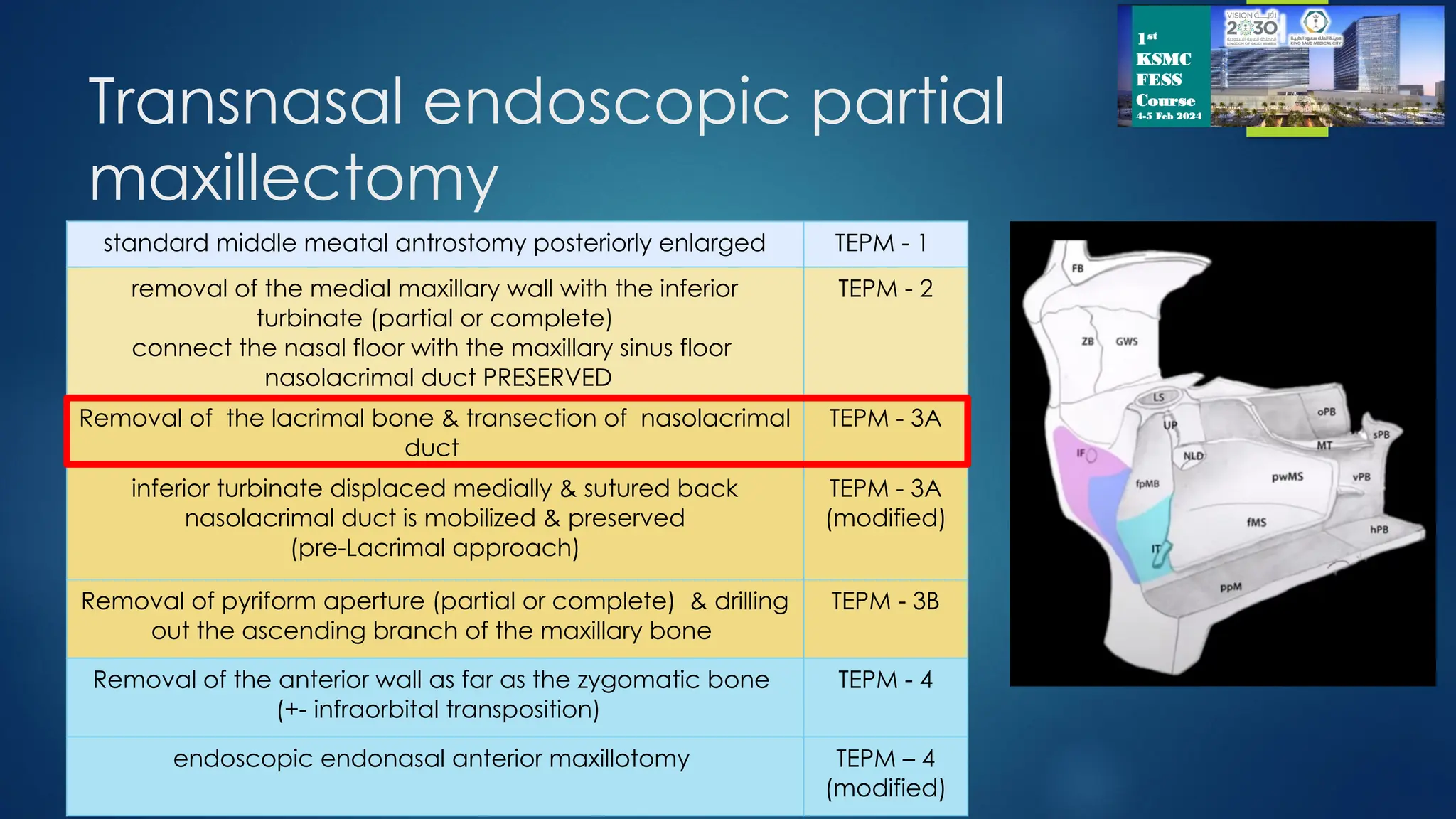 nasal septum ,lateral nasal wall anatomy | PPTX
