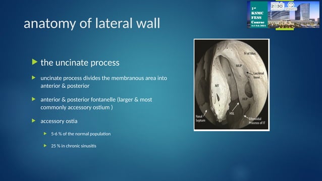 nasal septum ,lateral nasal wall anatomy | PPT