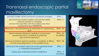nasal septum ,lateral nasal wall anatomy | PPTX
