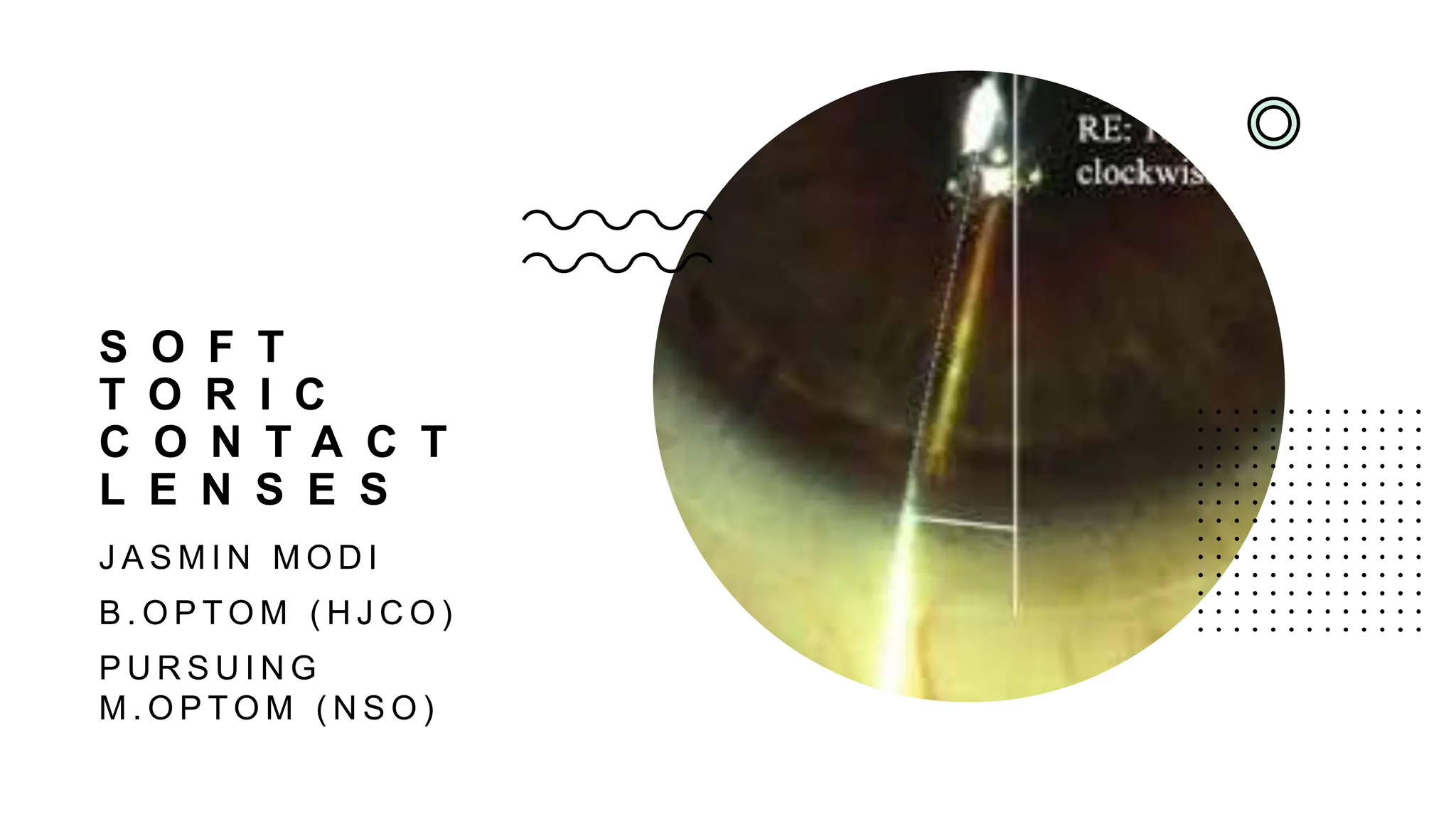 Soft Toric contact lens fitting (NSO).pptx | Eye and Vision Conditions ...