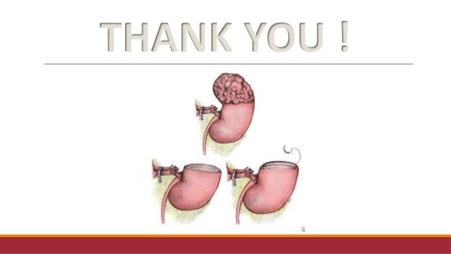 Nephron Sparing Surgery In Wilms